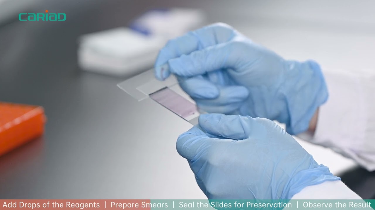 Sperm Vitality Staining Solution (Eosin-Nigrosin Staining)