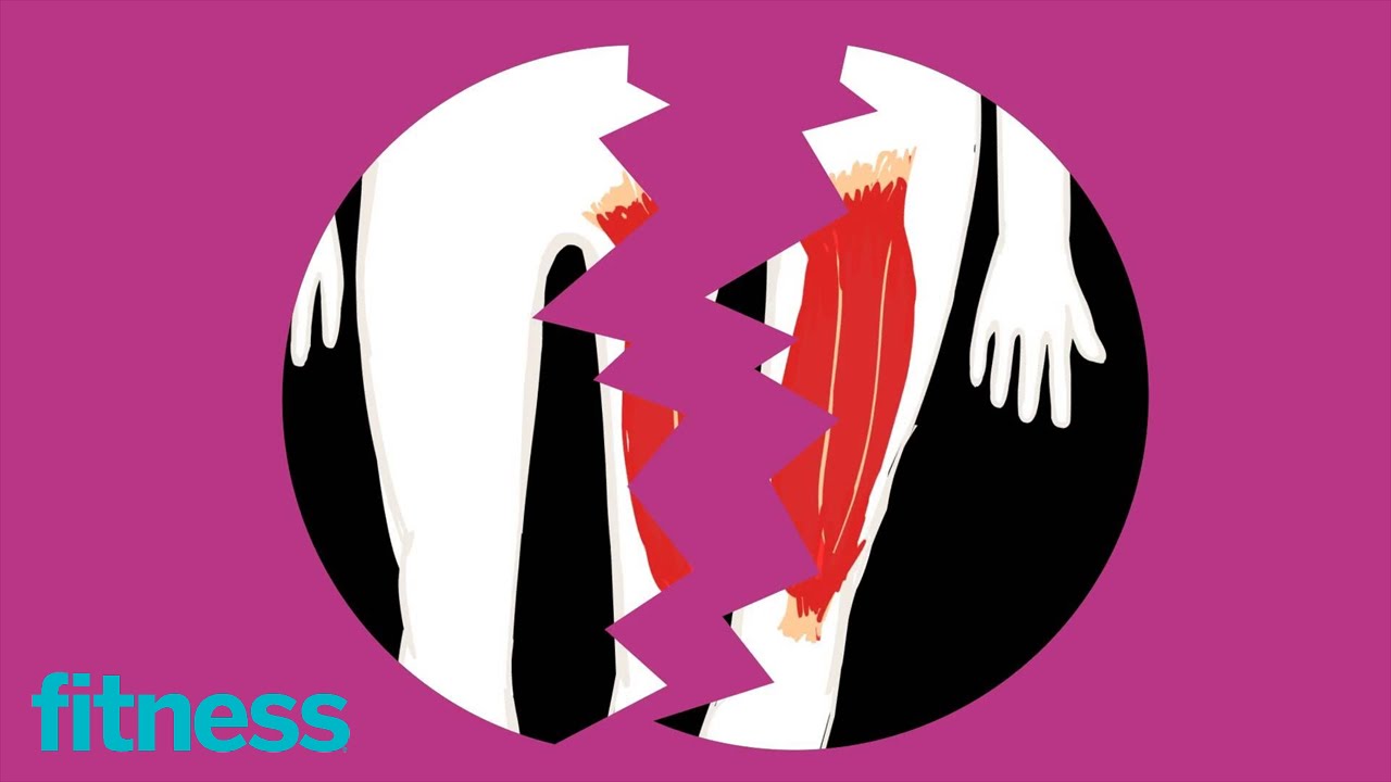 What is a muscle spasm? | Fitness