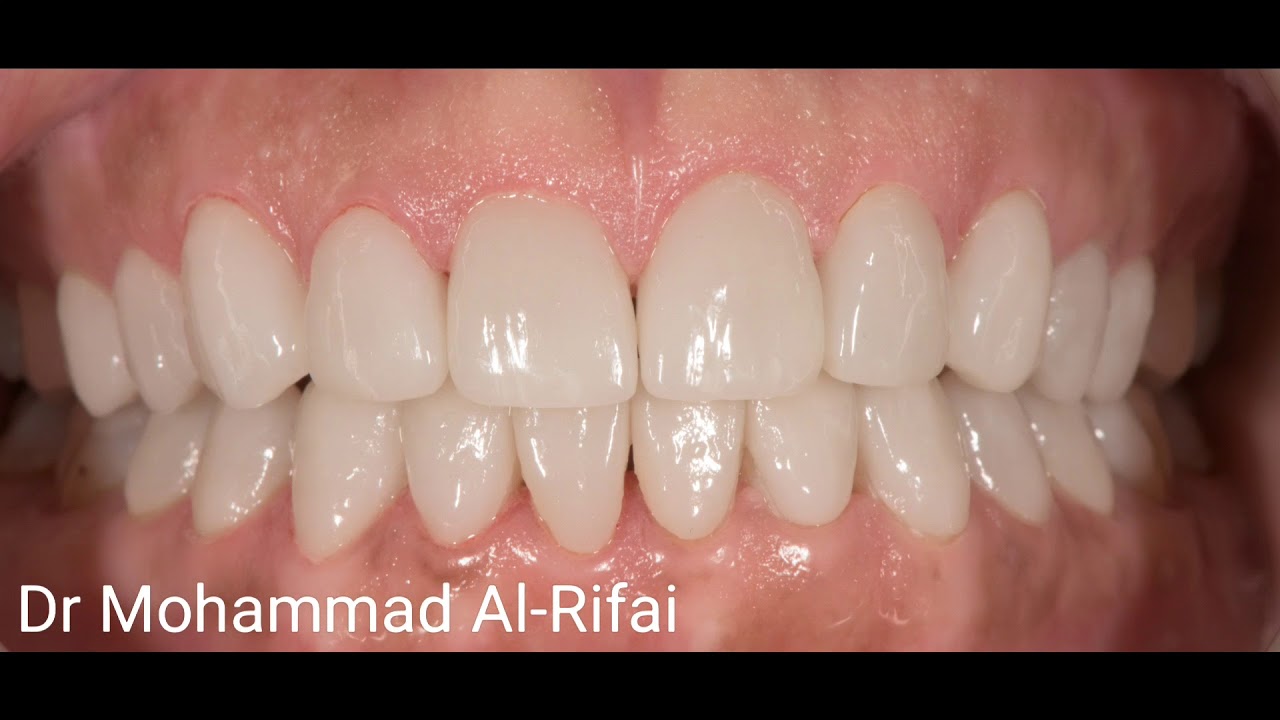 Dr. Mohammad Al Rifai – Al Ain, UAE