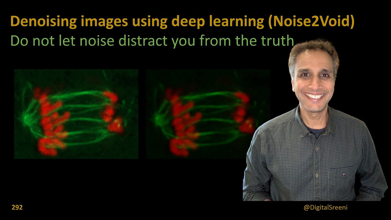 292 - Denoising images using deep learning (Noise2Void)​