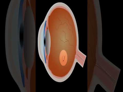 Laser Works | Science | Technology