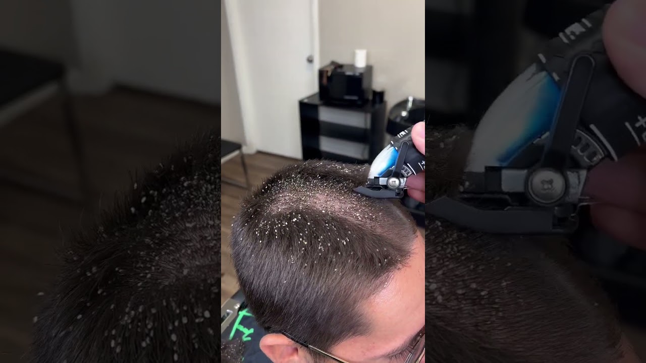 BARBER CUTS OFF LICE!!!! MUST WATCH