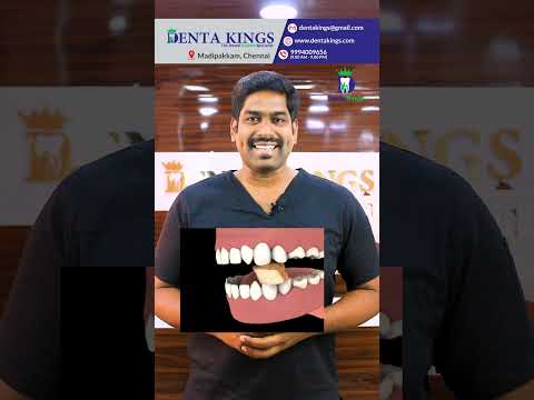 4 வகையான பற்களும் அதன் பயன்களும் - 4 Types of Teeth and It's Uses | Denta Kings | Dr. Karthikeyan