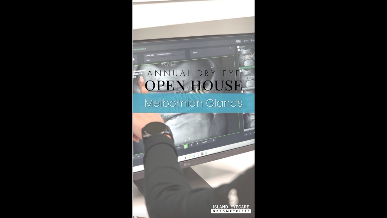 Meibography & Meibomian Glands