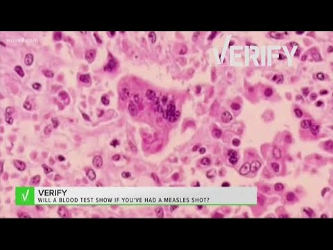 VERIFY: Will a blood test show if you've had a measles shot?