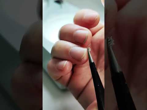 Worms ๐in nails science research ๐คฎ๐คฎ๐คขwe should cut our nails ๐
๐จ