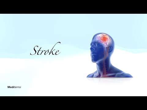 The word #Stroke