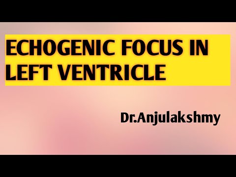 ECHOGENIC FOCUS IN LEFT VENTRICLE/Malayalam/Dr.Anjulakshmy