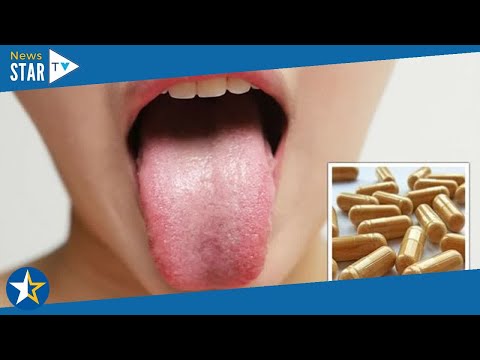 B12 deficiency: The signs in the shape of your tongue indicating low vitamin B12 levels