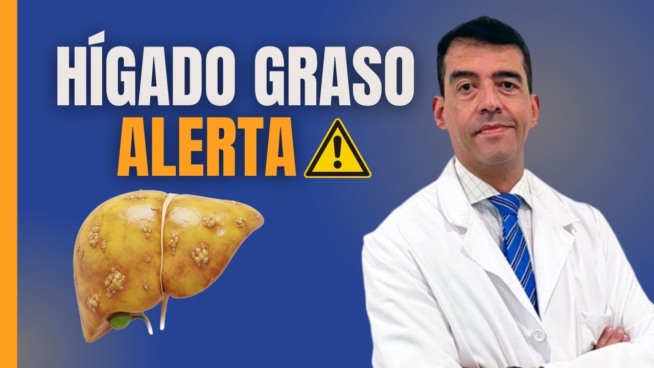 Esteatosis hepática (hígado graso): causas, diagnóstico y nuevos tratamientos 2025