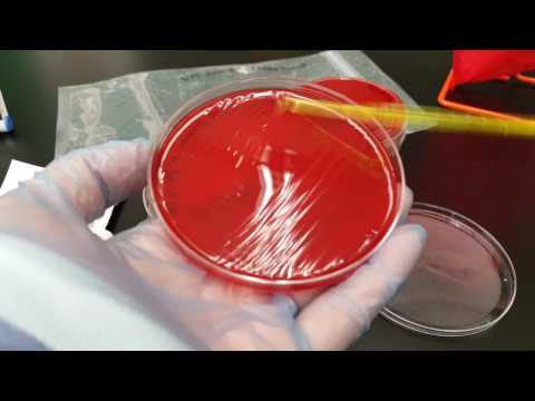 Microbiology: Anaerobic primary set-up from a stock culture