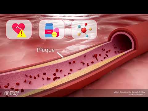 Second-Degree AV Block | Mobitz Type 1 vs Type 2 | Heart Block Animation | Swasth Hriday