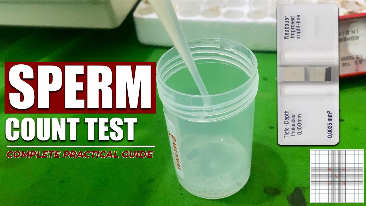 Sperm Count Lab Test | Semen Analysis | Complete video tutorial | Under Microscope