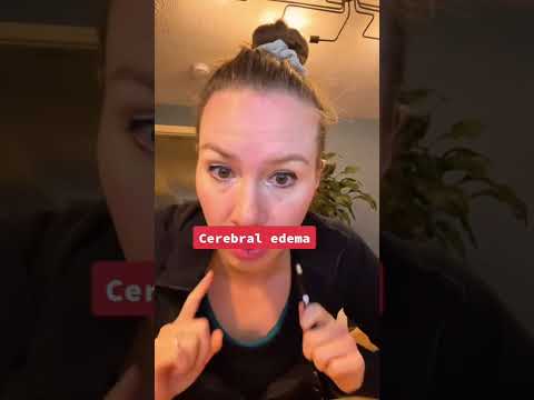 Hyponatremia implications [FOR NEURO NURSES]