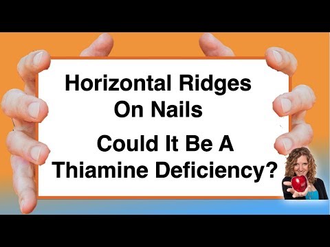 Could horizontal ridges on nails be a Thiamine deficiency? With Karen Langston