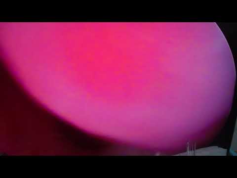 Nasendoscopy - left side 29 - 7 - 2019