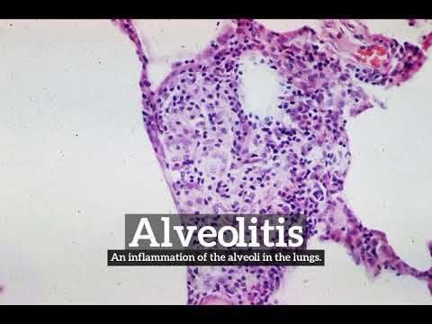 How Does Alveolitis Look? | How to Say Alveolitis in English? | What is Alveolitis?