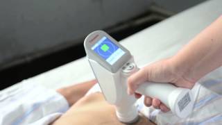 Caresono HD2 Handheld Bladder Scanner MD2