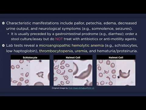 Hemolytic Uremic Syndrome (HUS)