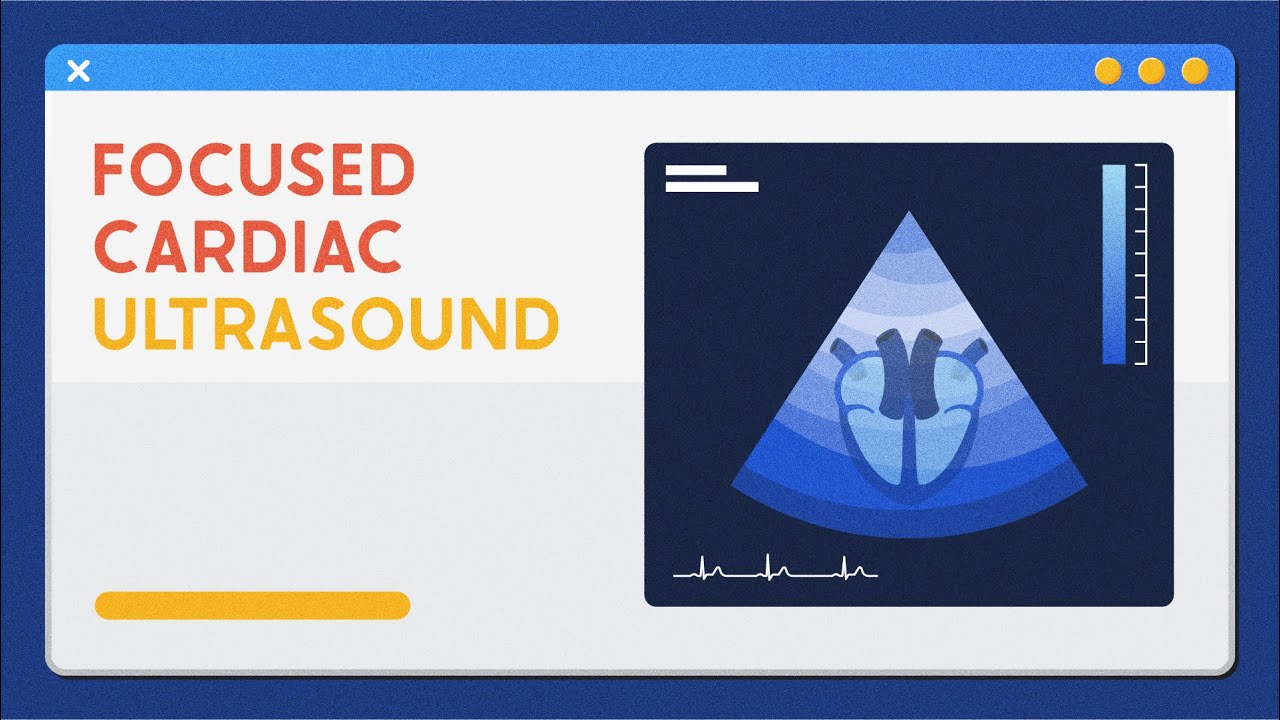 3. Left heart assessment
