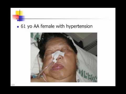 Drug Allergy (David, Khan, MD)