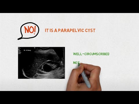 Renal cyst ultrasound: POCUS pearls and pitfalls by Dr. Koratala (@NephroP)