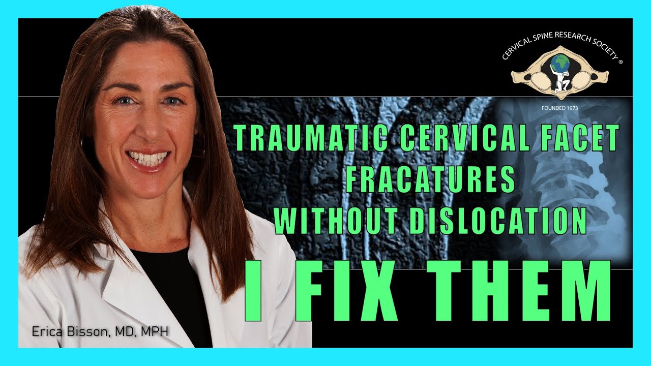 Traumatic Facet Fractures