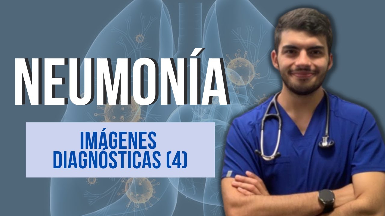 NEUMONÍA - Imágenes diagnósticas (Parte 4)