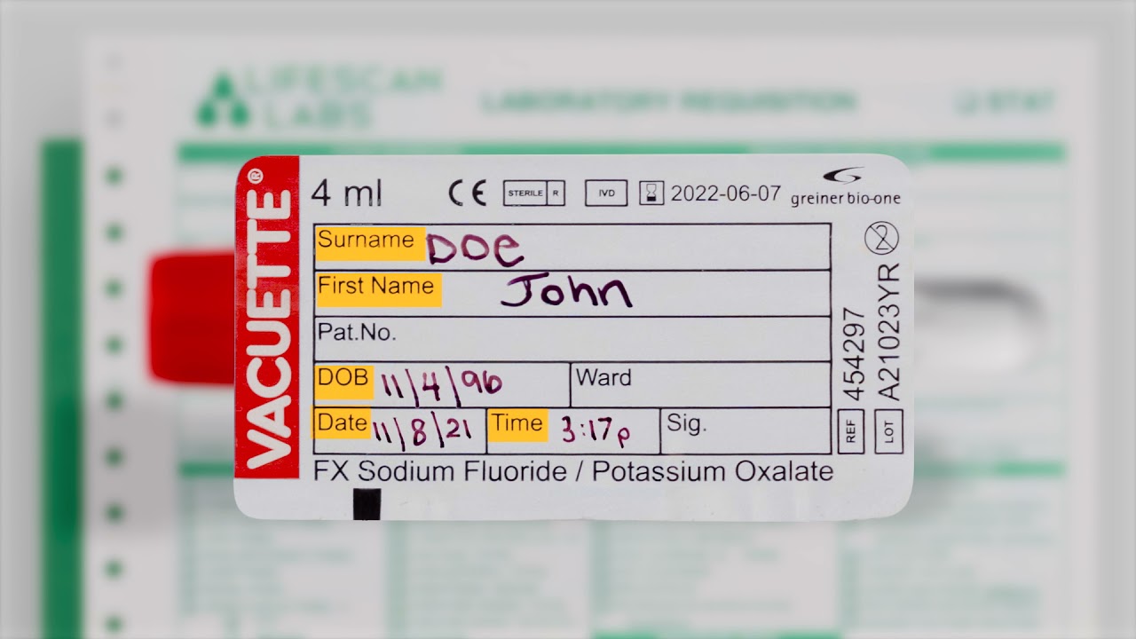 Properly Labeling Specimen