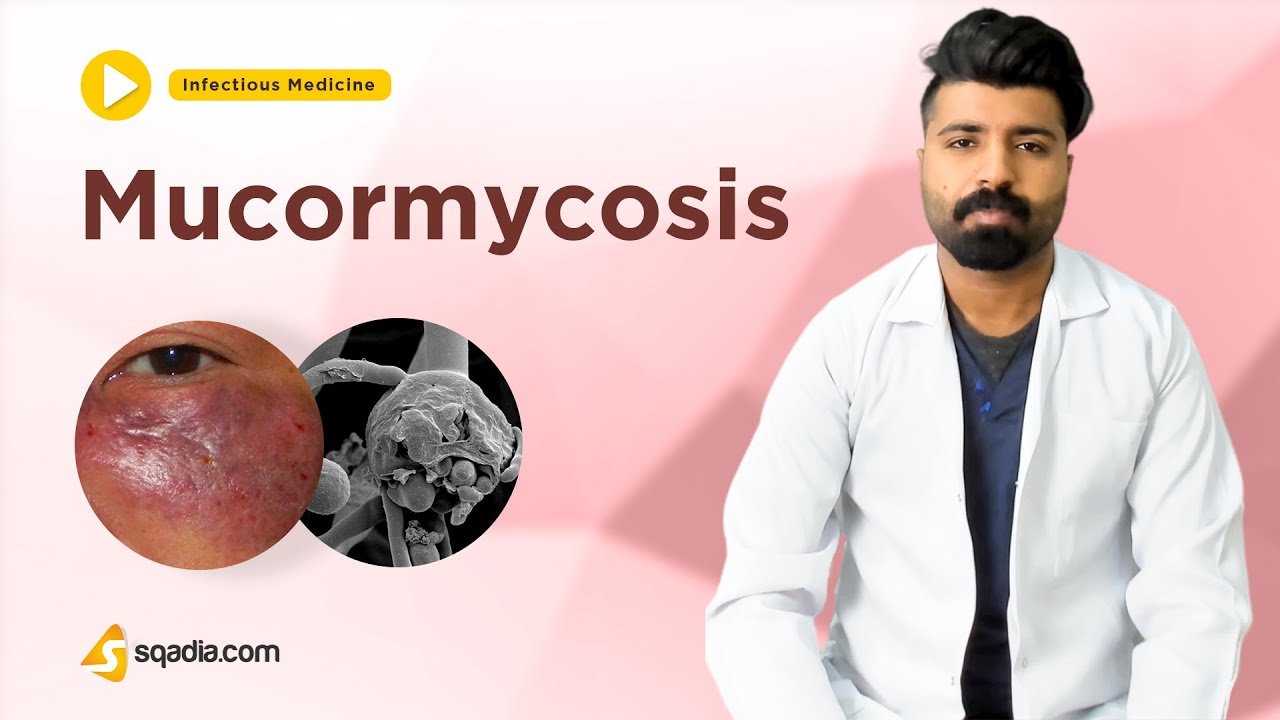 Mucormycosis | Infectious Medicine | Clinical Video Lectures | V-Learning | sqadia.com