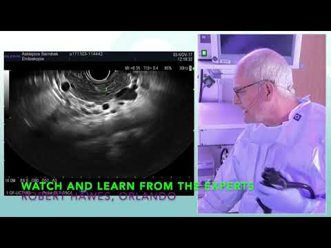 Robert Hawes EOA 2020 June 5 Trailer