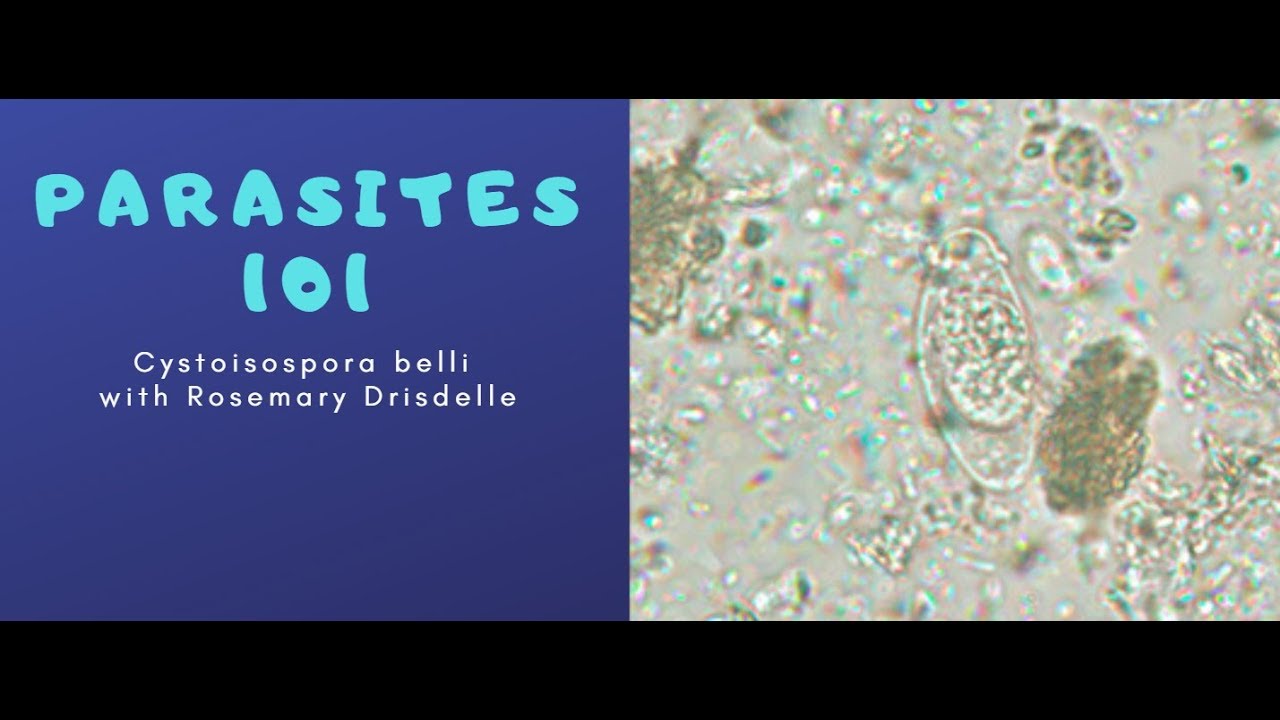 Cystoisospora belli: The least common of the three intestinal coccidia