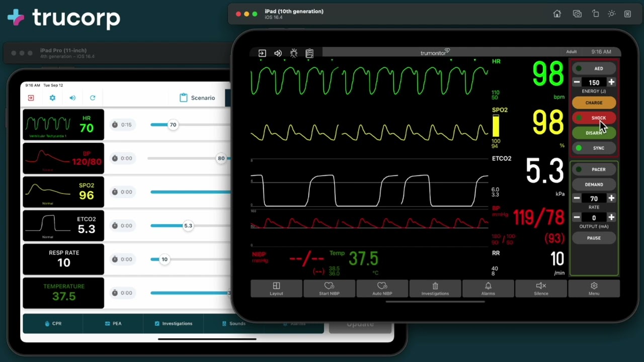 TruMonitor Quick Start - Defib & CPR