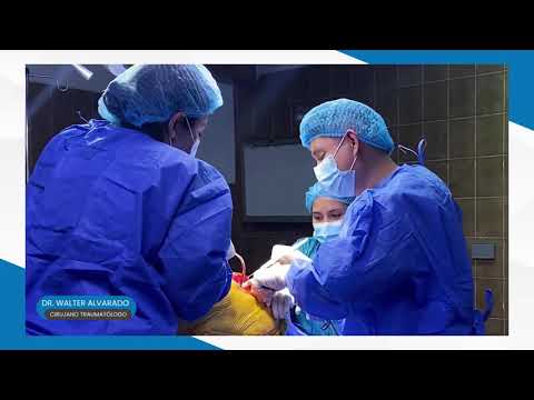PRÓTESIS DE CADERA EXPLICACIÓN POR DR. WALTER ALVARADO