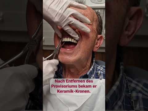 Patient ist happy mit seinen Keramik-Kronen - bei Zahnarzt in Bad Nauheim, Hessen