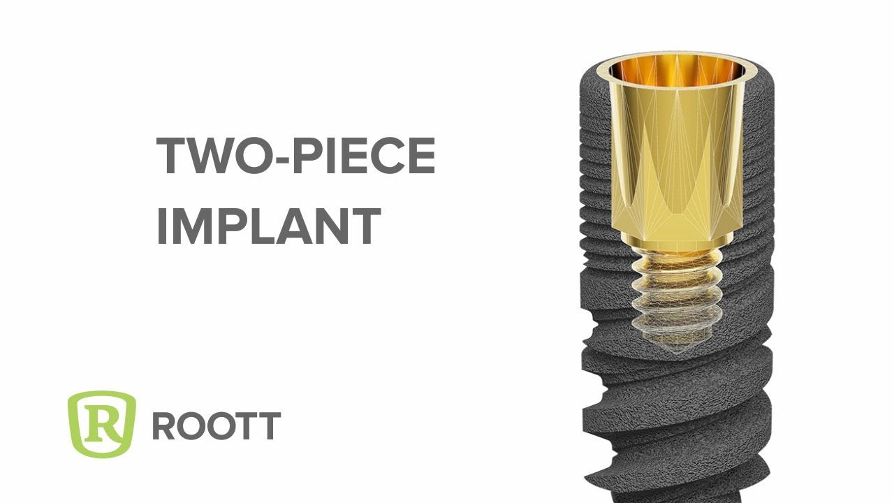 ROOTT R Dental implants