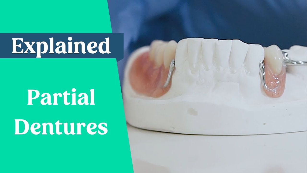 Partial Dentures for Front Teeth - Peridot Dental Care