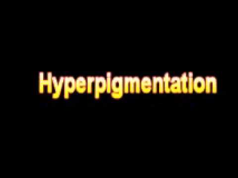 What Is The Definition Of Hyperpigmentation - Medical Dictionary Free Online Terms