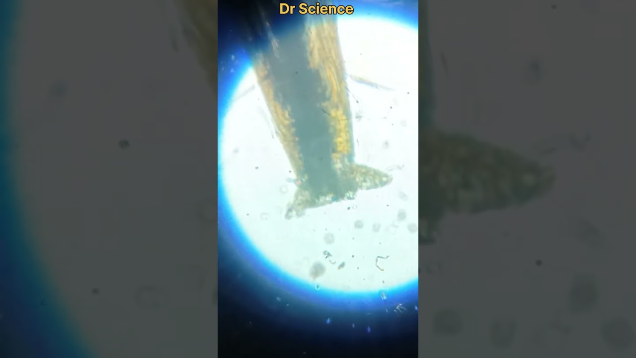 Mosquito Larvae Under Microscope | Dr Science