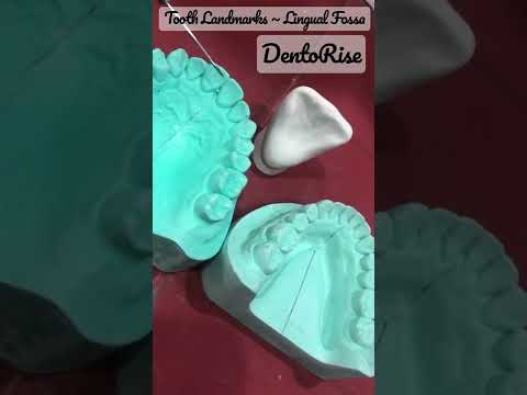 Landmarks on tooth surfaces | LINGUAL FOSSA | Short video LINK IN DESCRIPTION | Dental Anatomy