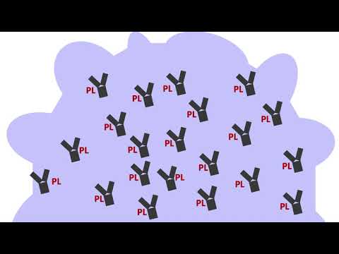Antiphospholipid Antibody Syndrome
