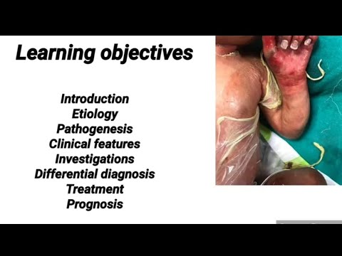 Staphylococcal Scalded Skin Syndrome | SSSS | Pediatrics