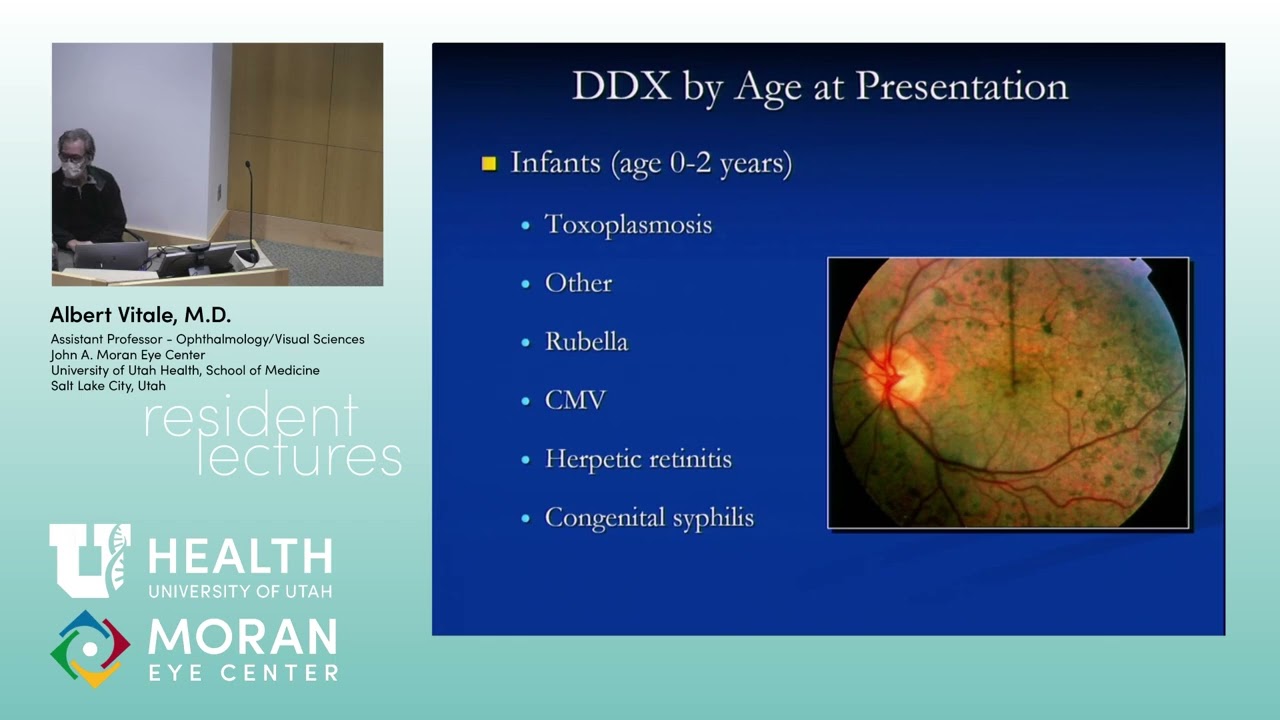 Anterior Uveitis (Pediatric) and Intermediate Uveitis [ARCHIVE]
