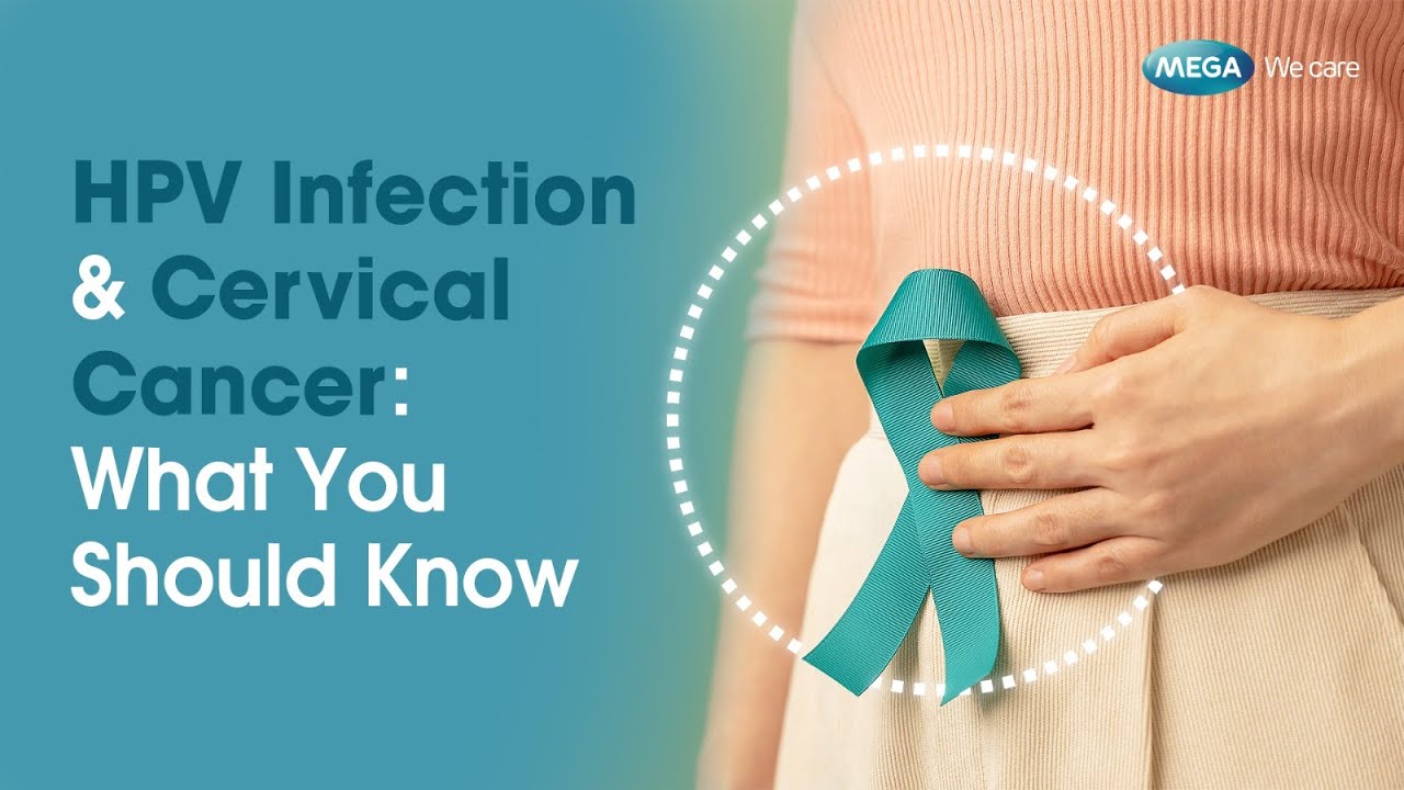 Understanding HPV Infection and Cervical Cancer