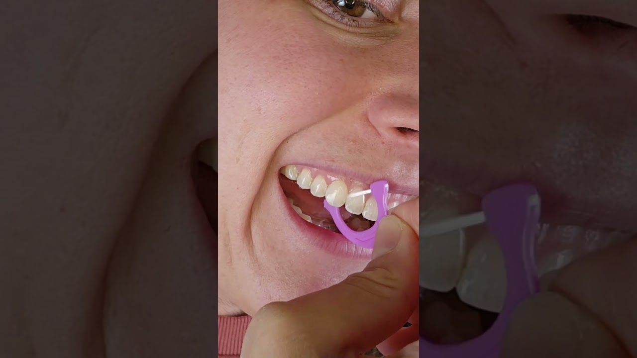 String Struggles: When Flossing Goes Fantastically (and Funnily) Wrong