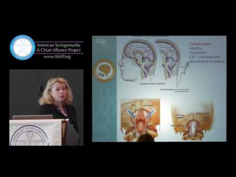 2016 ASAP CM/SM Conference "Syringomyelia:..." Dr. Jacques