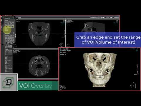 How to: Use General Tools on OnDemand3D