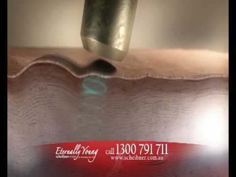 Eternally Young - Laser Rejuvenation by the Scheibner Centre