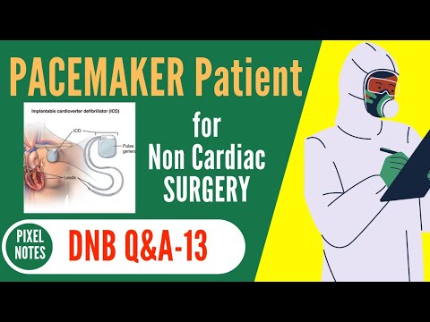 Anesthesia in Patients with PACEMAKER | PPM | AICD | CIED