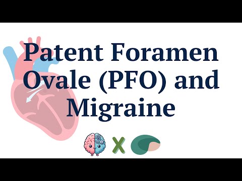 Patent Foramen Ovale (PFO) and Migraine: Is there a relationship?